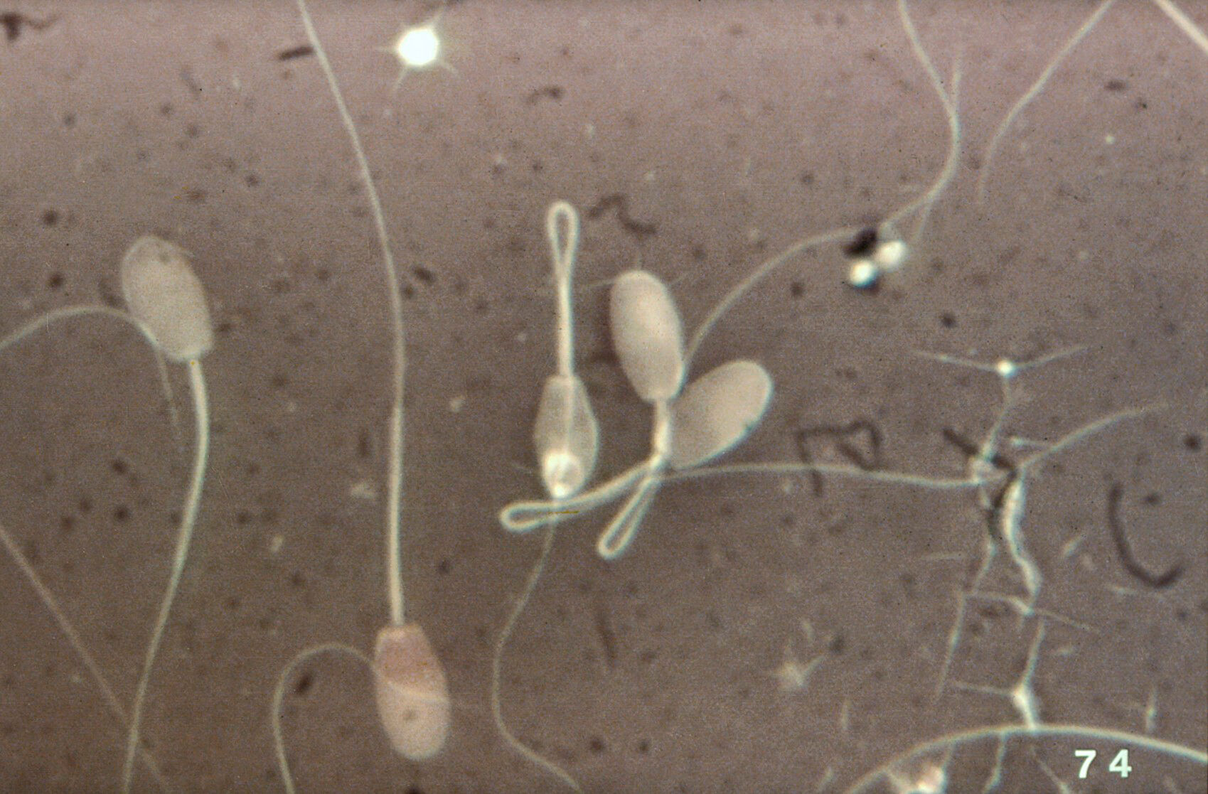 Microscopic examination of ram's semen smear | Wellcome Collection