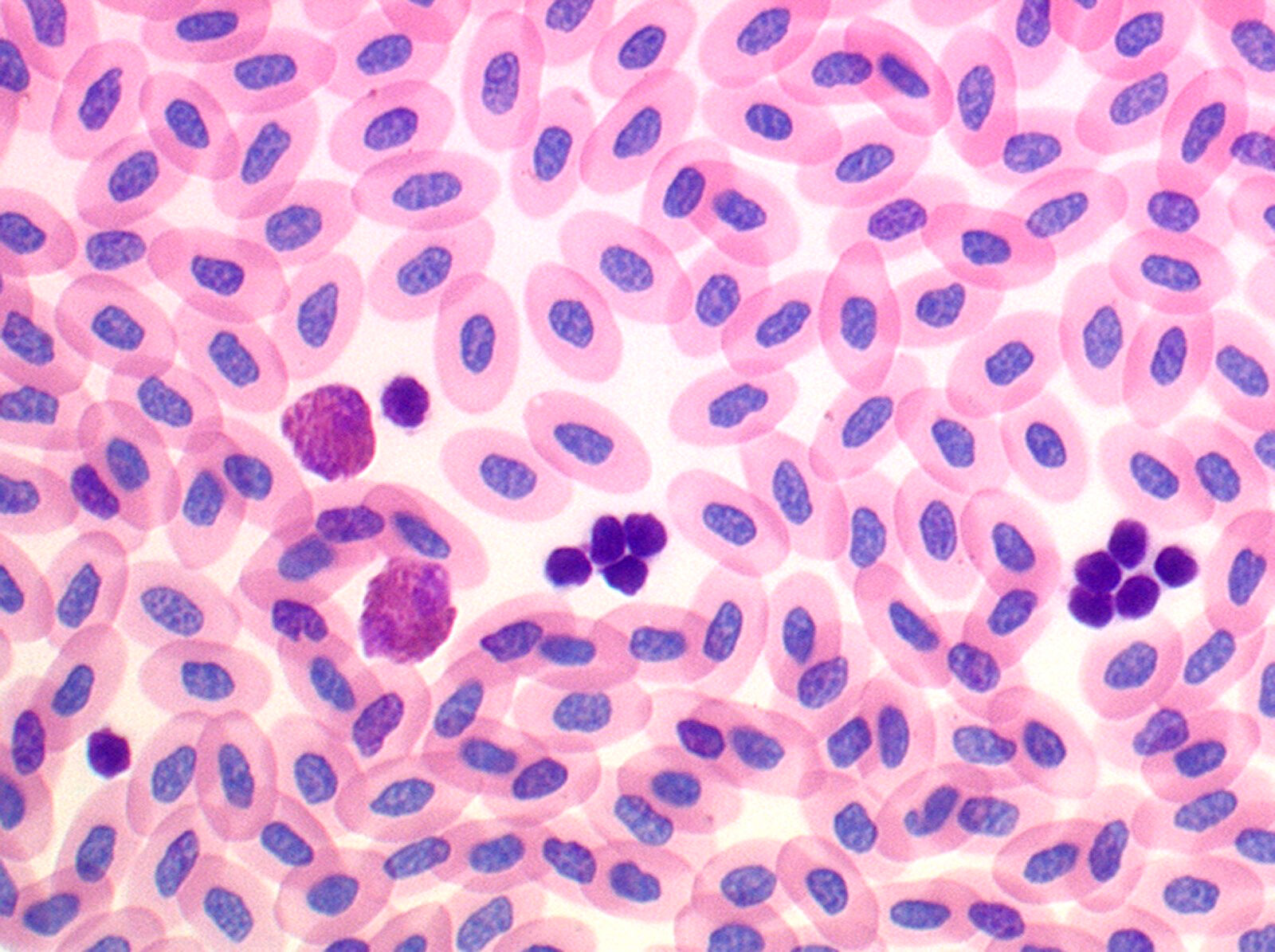 Avian blood | Wellcome Collection