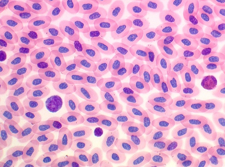 Avian blood | Wellcome Collection