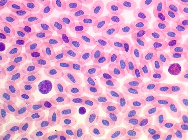 Avian blood | Wellcome Collection