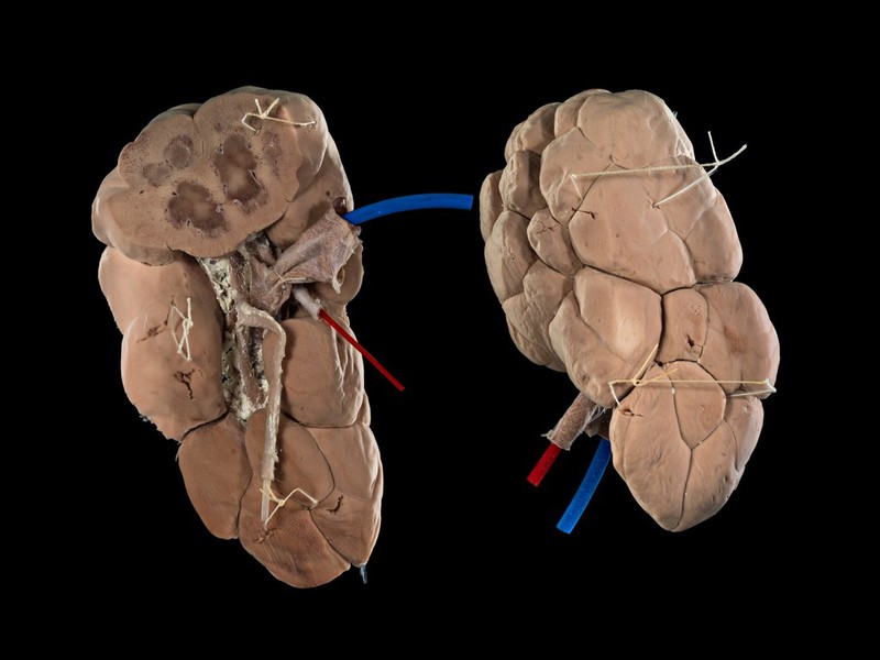 Bovine kidneys | Wellcome Collection
