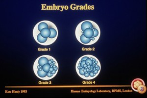 Human embryo grades | Wellcome Collection