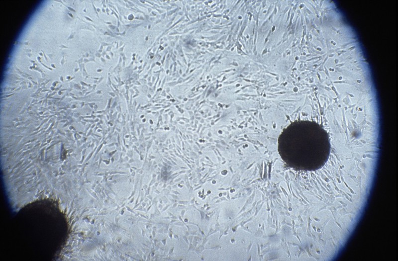 Foetal cells from amniotic fluid in culture | Wellcome Collection