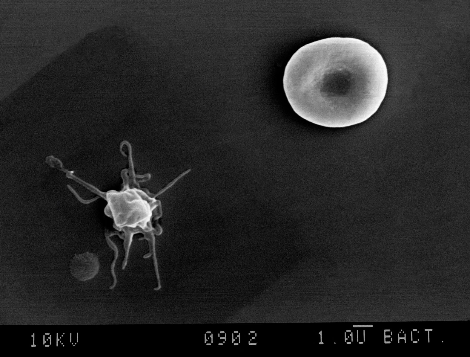 SEM of platelet and red blood corpuscle | Wellcome Collection