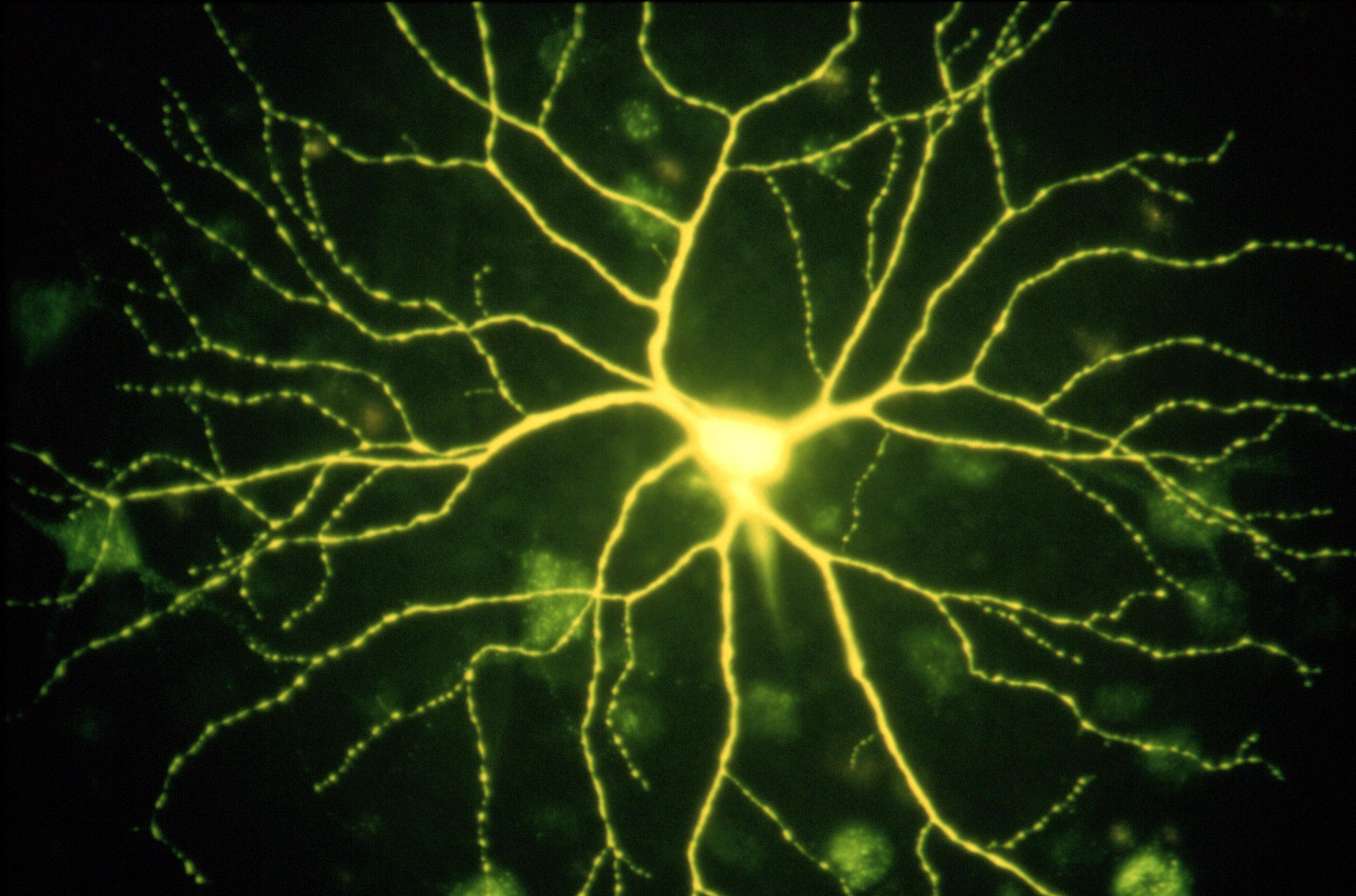 Alpha cell in the ferret retina | Wellcome Collection