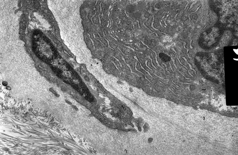 Fibroblasts with organelles - TEM | Wellcome Collection