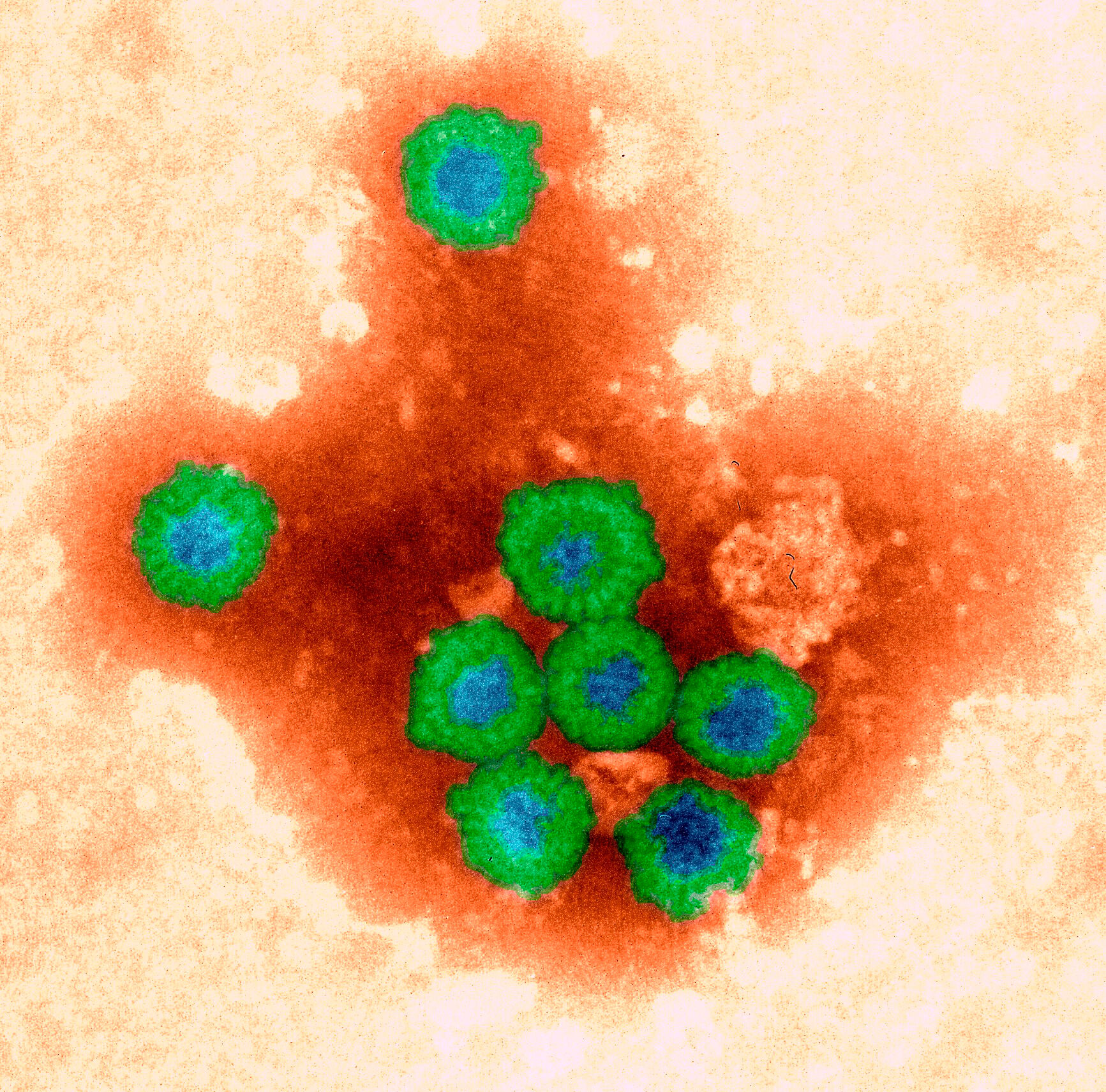 Rotavirus, electron micrograph - coloured | Wellcome Collection