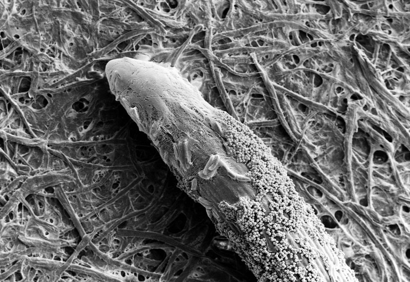 SEM Phytophthora spores on rye grass root | Wellcome Collection