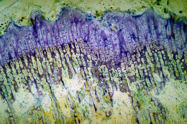 Growing bone | Wellcome Collection