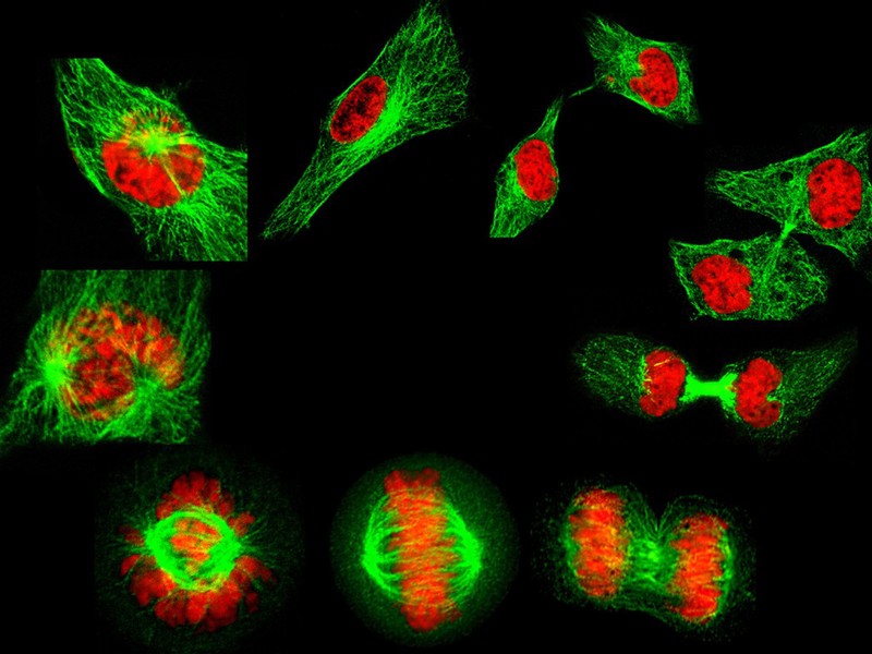 Human cells showing the stages of cell division starting with ...