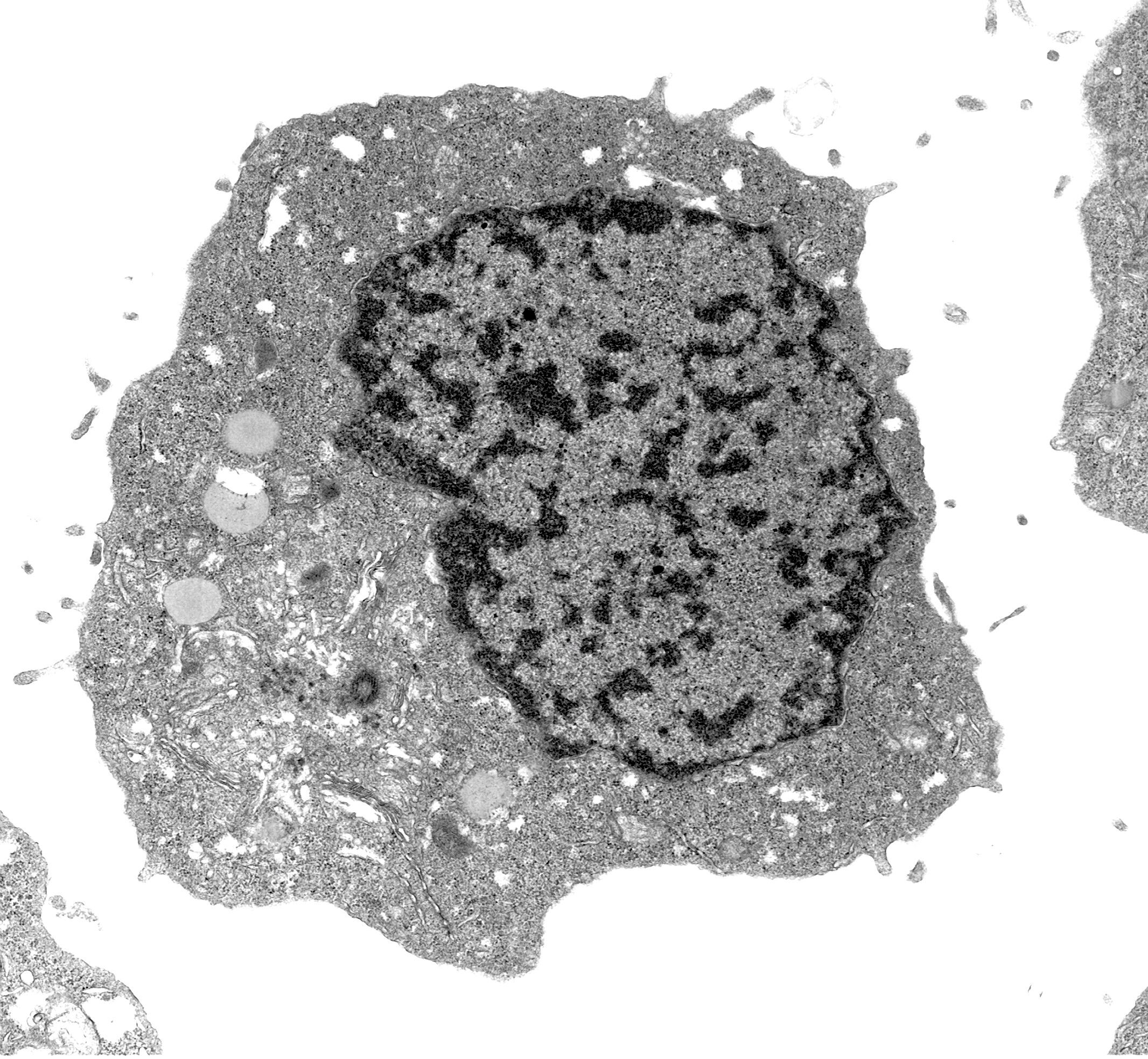 TEM normal cell | Wellcome Collection