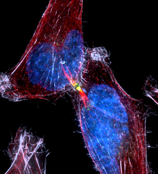 Human HeLa cancer cells, cytokinesis | Wellcome Collection