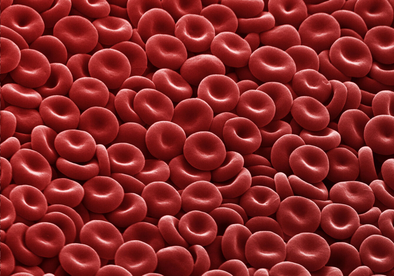 Red blood cells clearly showing their biconcave disc shape. | Wellcome ...