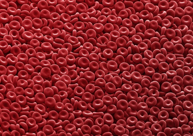 Red blood cells clearly showing their biconcave disc shape. | Wellcome ...