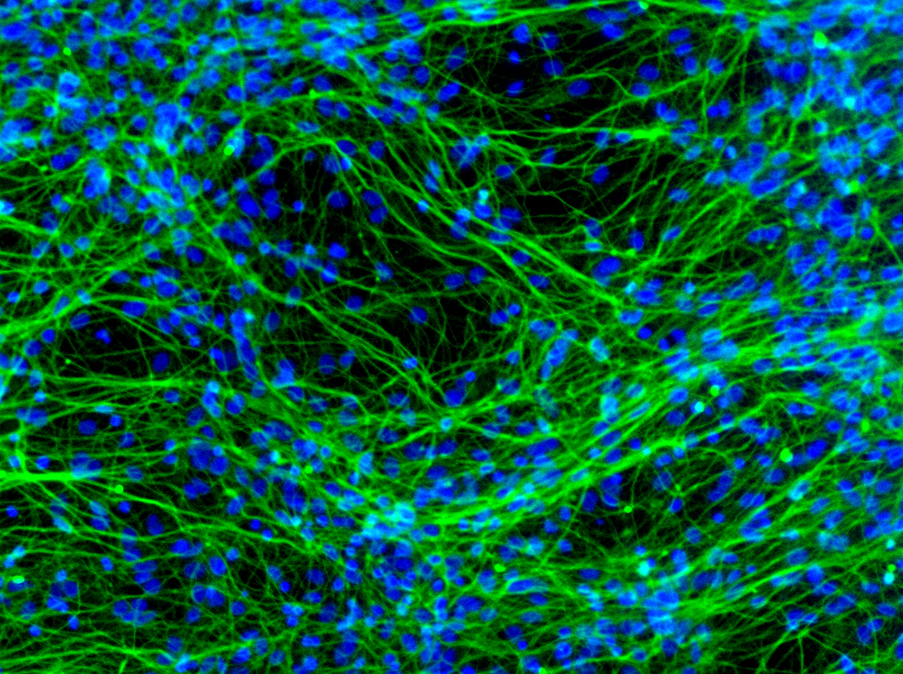 Neurons derived from human neural stem cells. The green staining ...