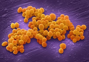 MRSA | Wellcome Collection