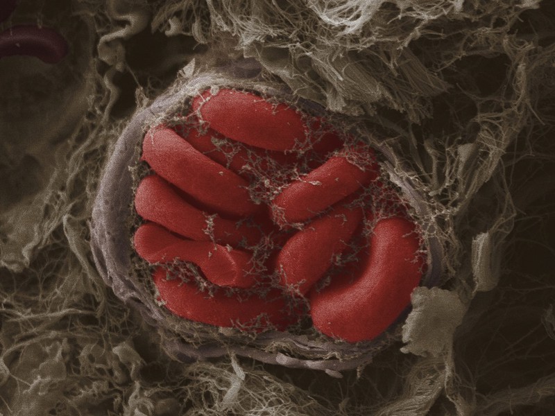 Blood vessel | Wellcome Collection