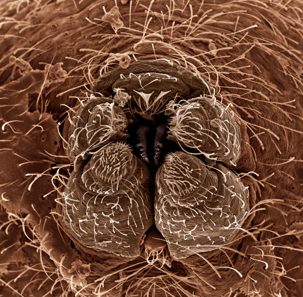 Spider spinneret (Un… | Wellcome Collection