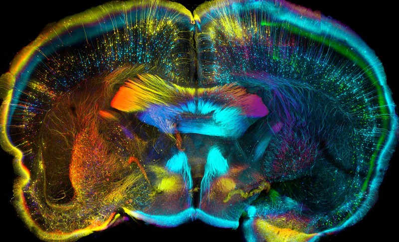 Mouse brain, coronal view. | Wellcome Collection