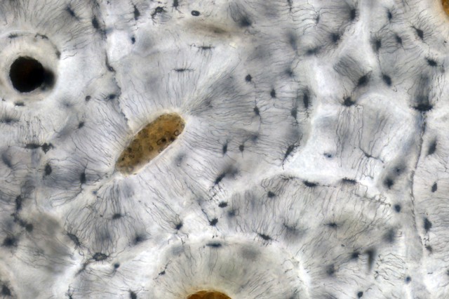 Osteocytes, canaliculi and haversian canals in bone, LM | Wellcome ...