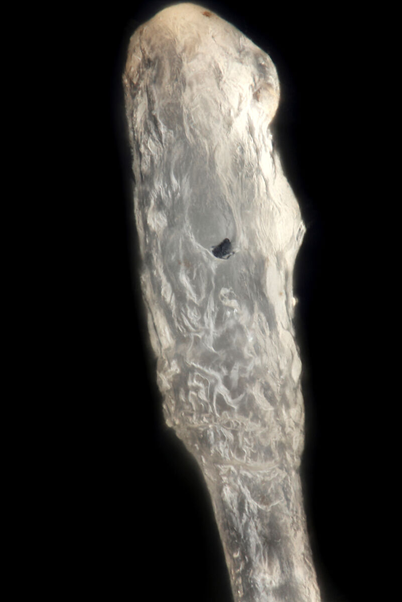 Eyelash root | Wellcome Collection