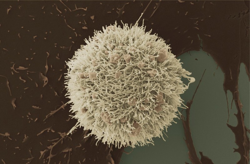 HeLa cell, immortal human epithelial cancer cell line, SEM | Wellcome ...