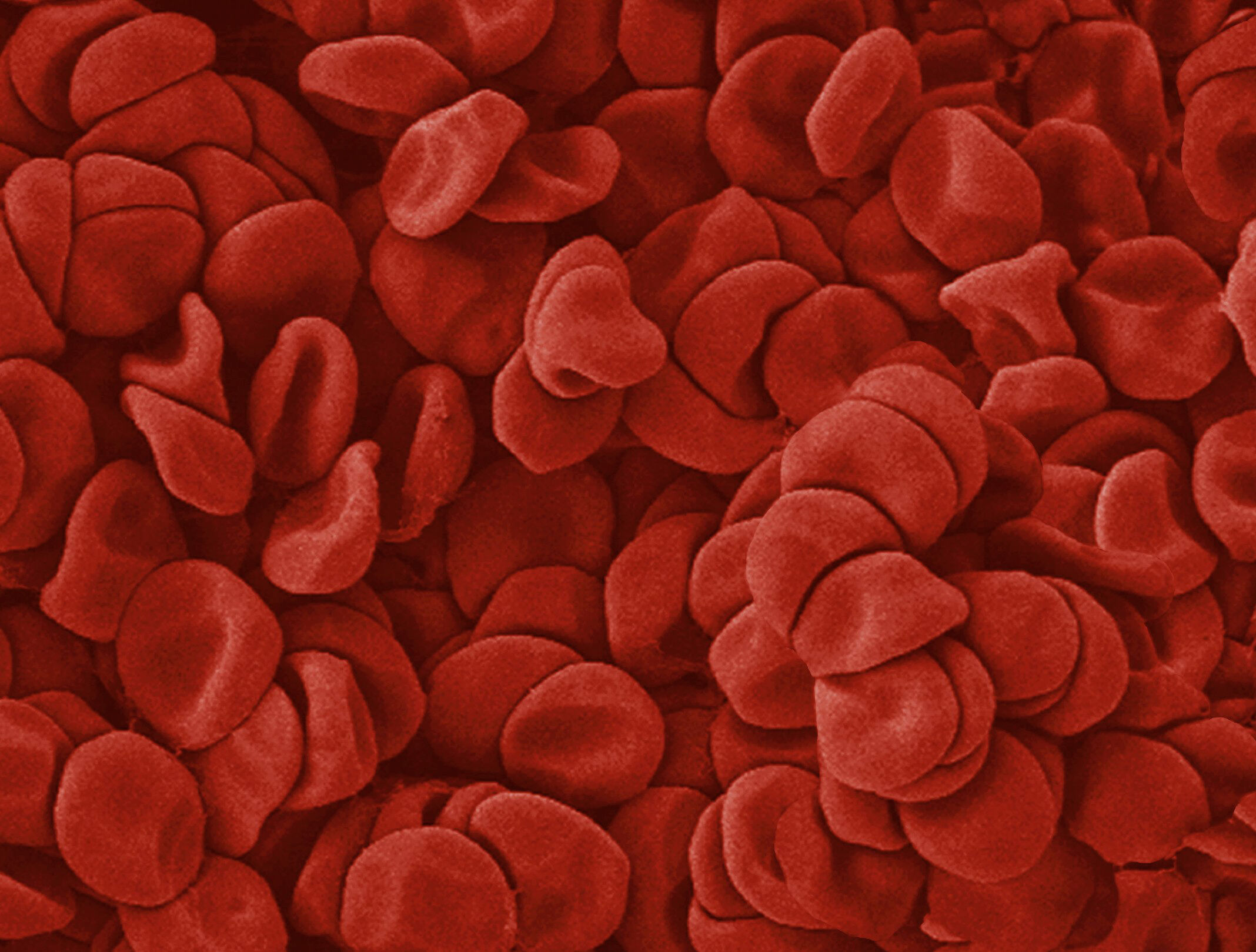 Blood Cells, SEM | Wellcome Collection