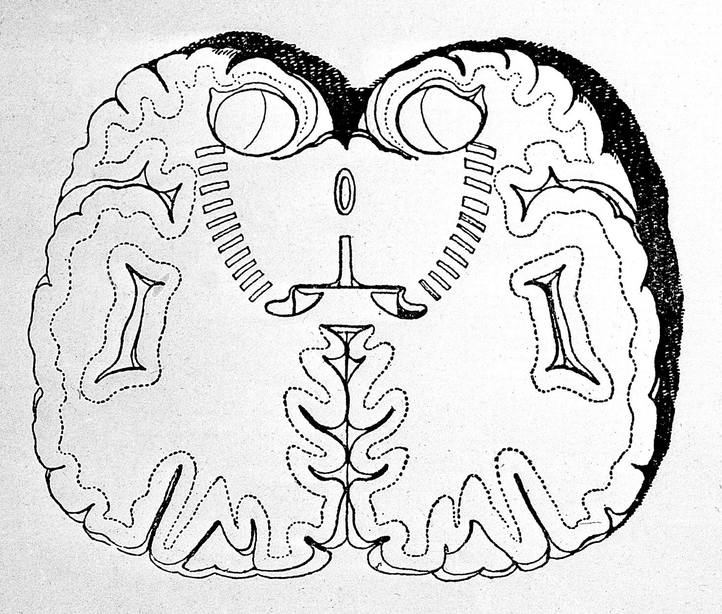 Plate showing coronal section of brain. | Wellcome Collection