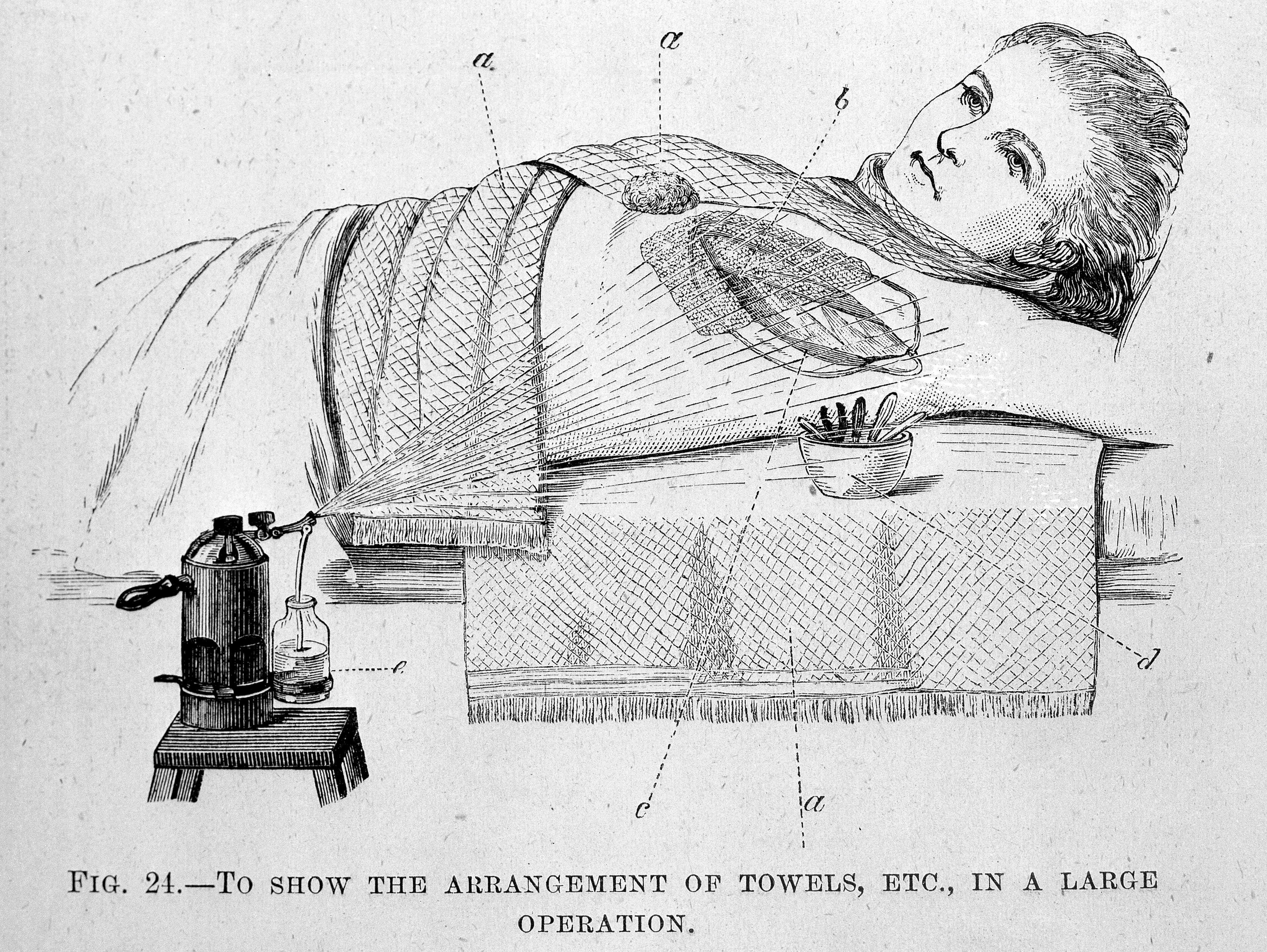 Joseph Lister Pioneer Of Antiseptic Surgery Design Week Joseph Lister Pioneer Of Antiseptic Surgery Design Week