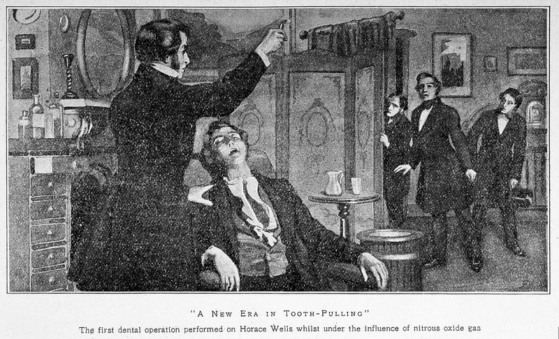 "A new era of tooth-pulling", first dental operation performed on ...