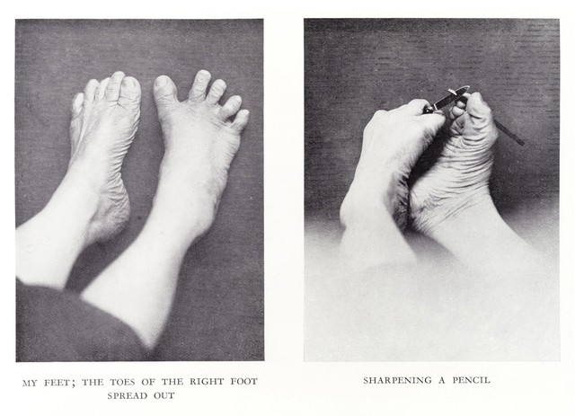 The feet of C. H. Unthan, the armless fiddler. (R) My Feet: The toes of ...