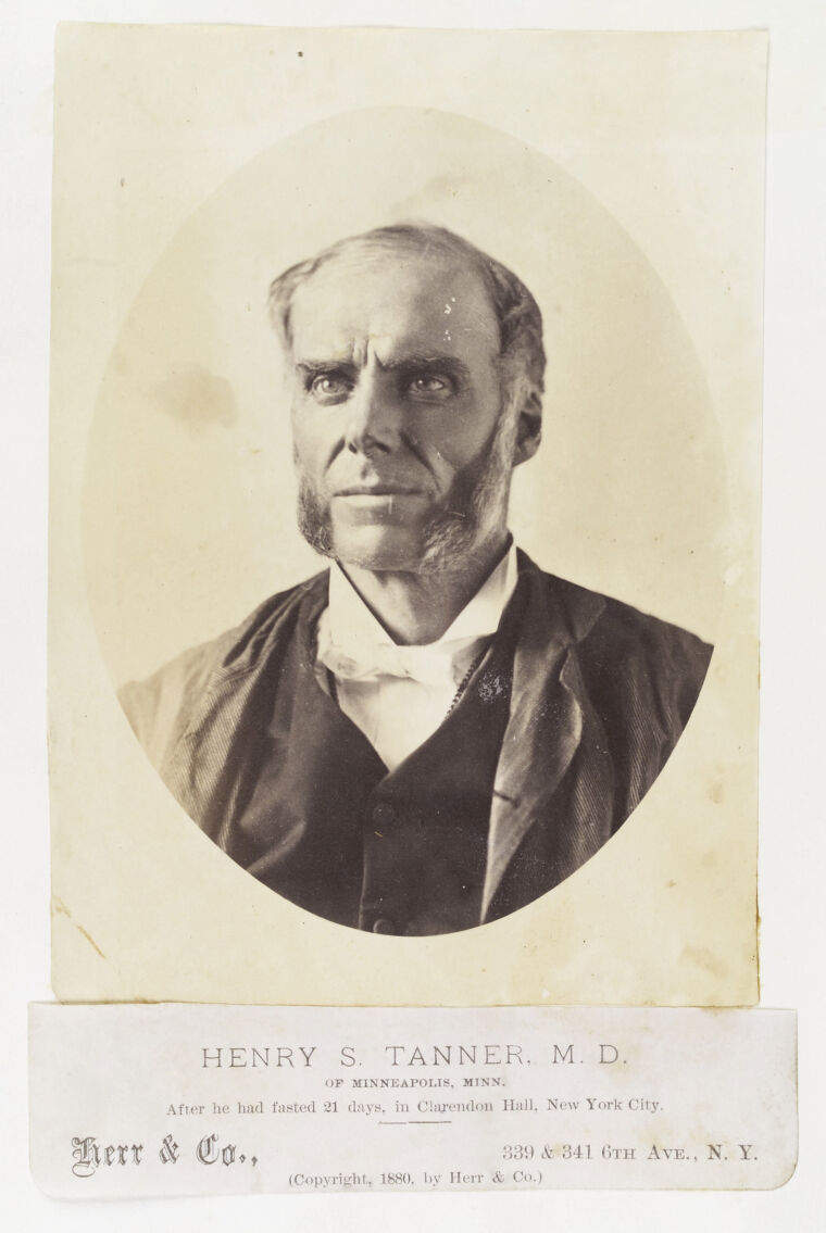 Henry S. Tanner after 21 days of his 40-day fast at Clarendon Hall, New ...