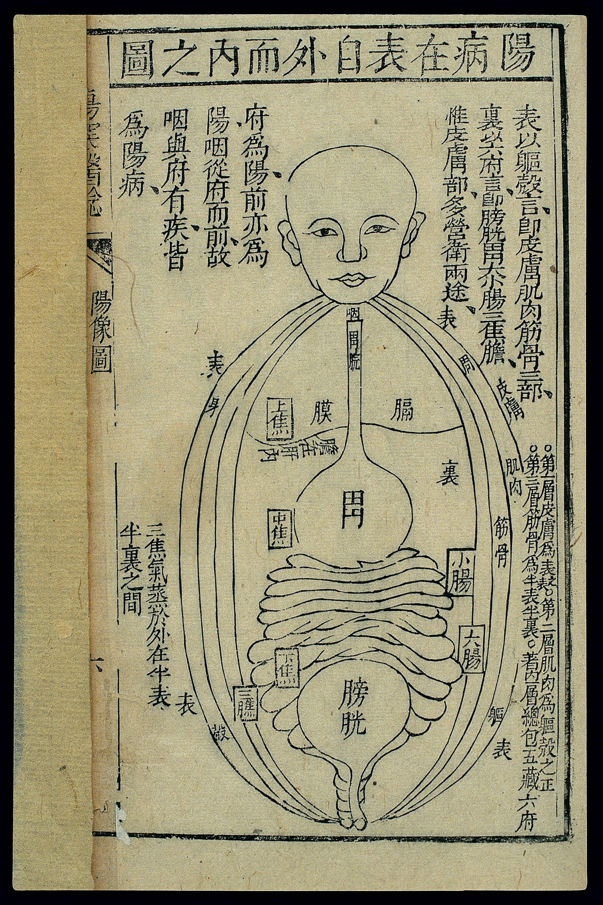 Transmission of Yang diseases from exterior to interior | Wellcome ...