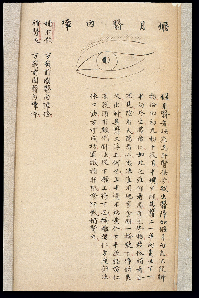 Illustration from Ming Chinese ophthalmology text, Ms copy | Wellcome ...