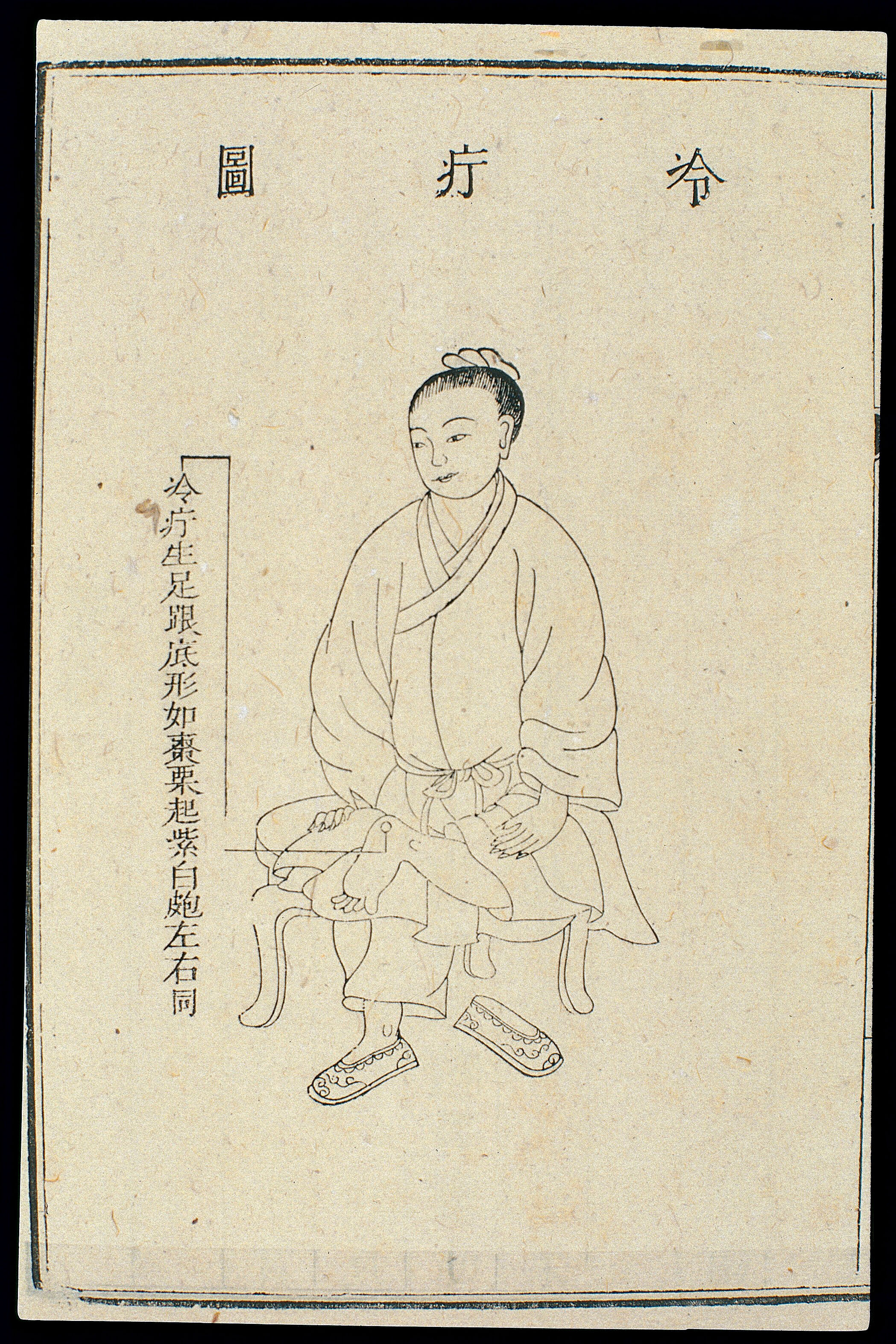 Chinese C18 woodcut: External medicine - Cold boil | Wellcome Collection