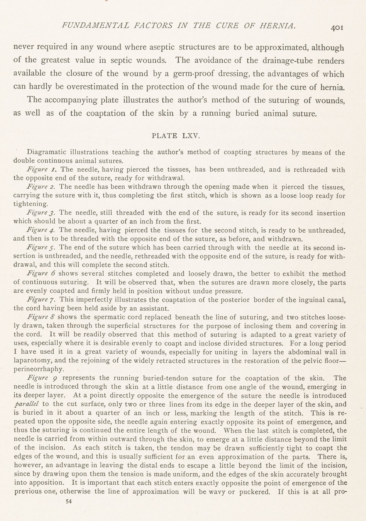 Marcy, Henry O. (Henry Orlando), 1837-1924 | Wellcome Collection