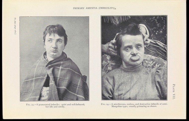 'Primary Amentia (Imbecility)' | Wellcome Collection