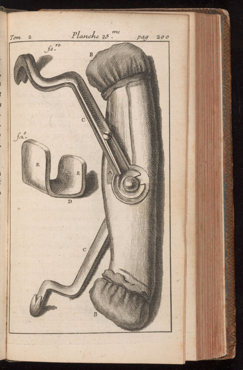 Dental pelican for tooth extraction, 18th century. | Wellcome Collection