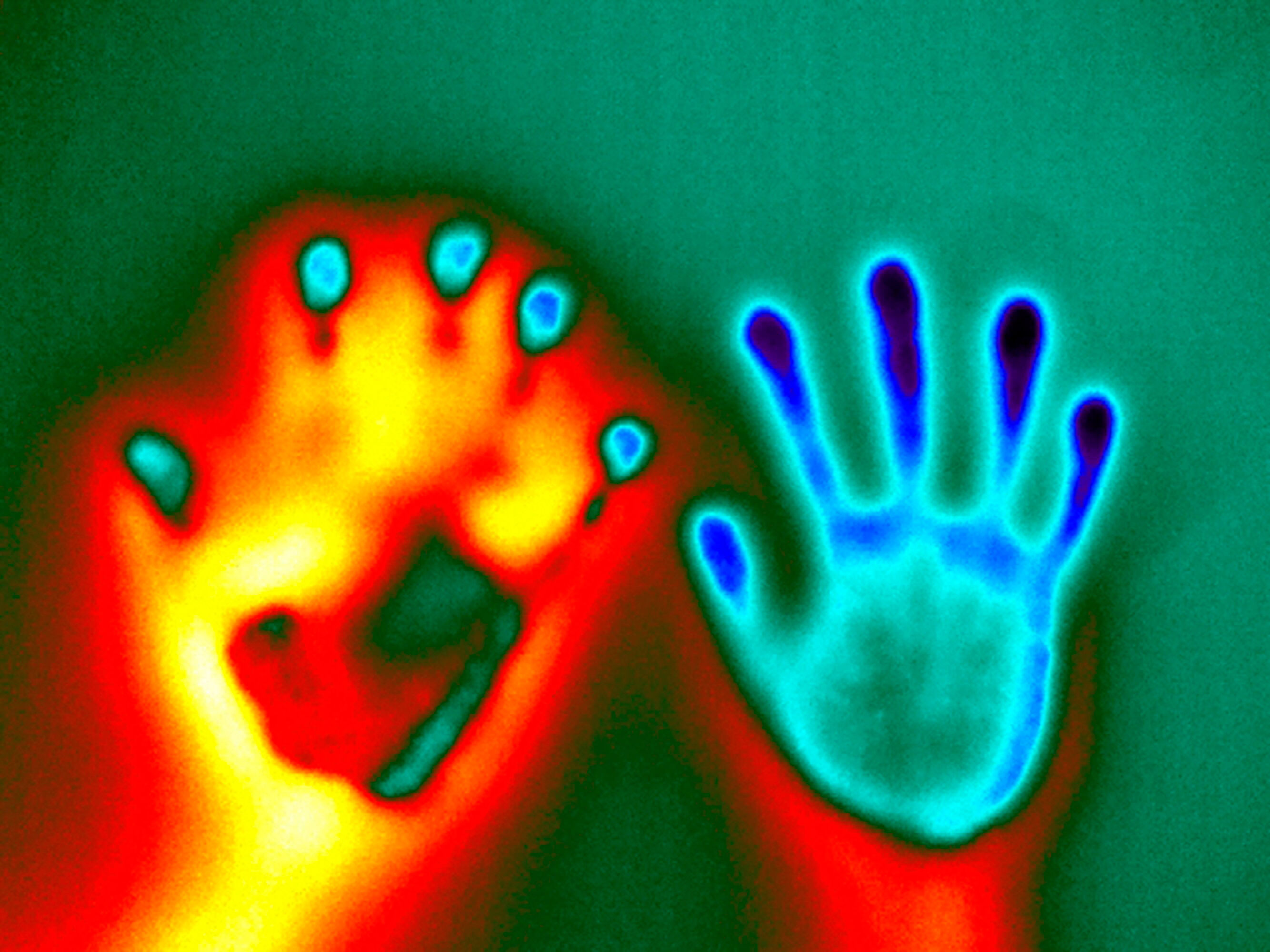 Thermal hand prints | Wellcome Collection