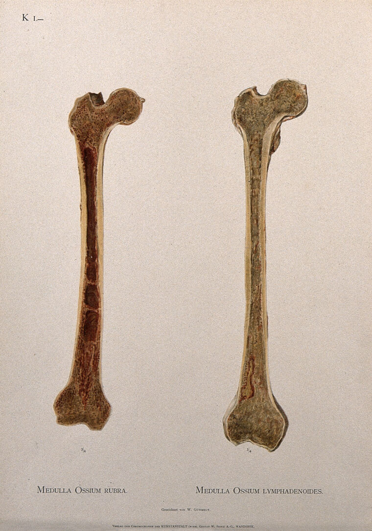 Sections through two femur bones: the left illustration indicating the ...