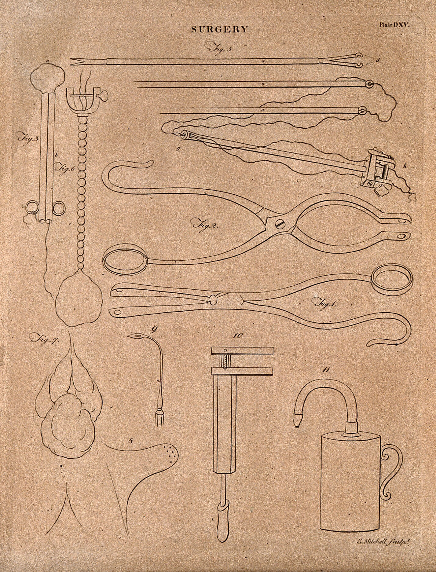 Surgical instruments. Engraving by E. Mitchell. | Wellcome Collection