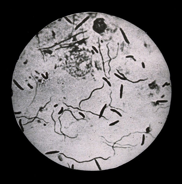 Fusiform bacillus, microscopic view. Photograph, [ca. 1930]. | Wellcome ...