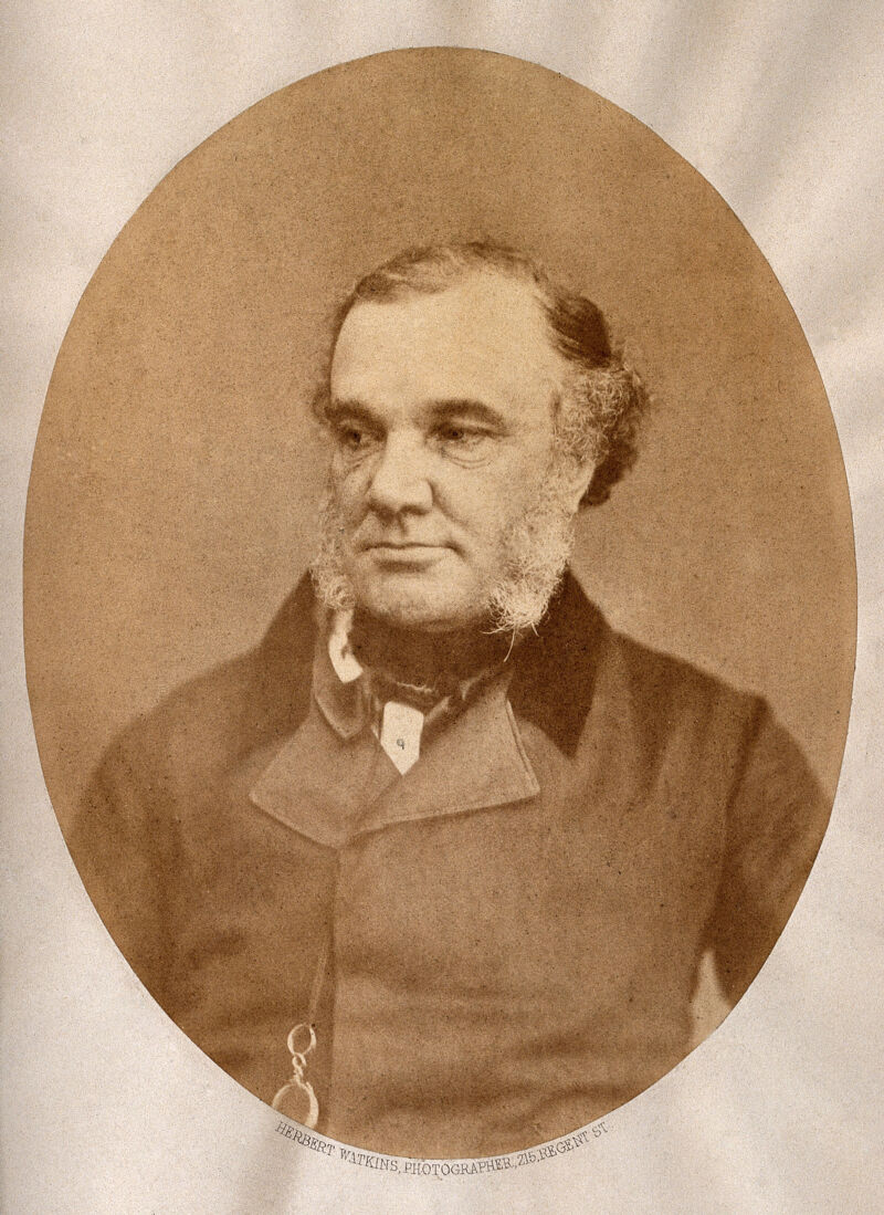 Thomas Addison. Photograph by H. Watkins. | Wellcome Collection