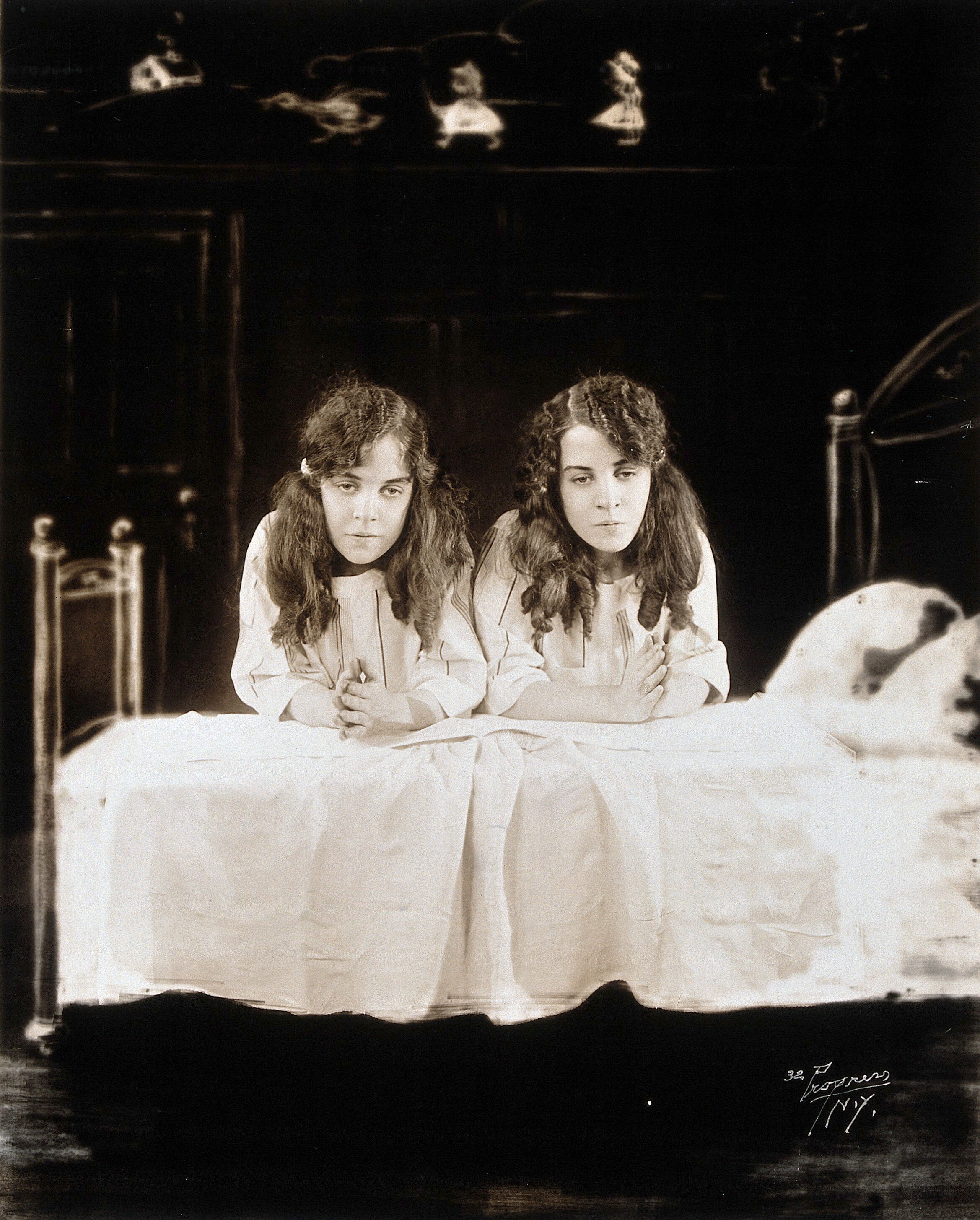 Daisy and Violet Hilton, conjoined twins, dressed for bed, kneeling to ...