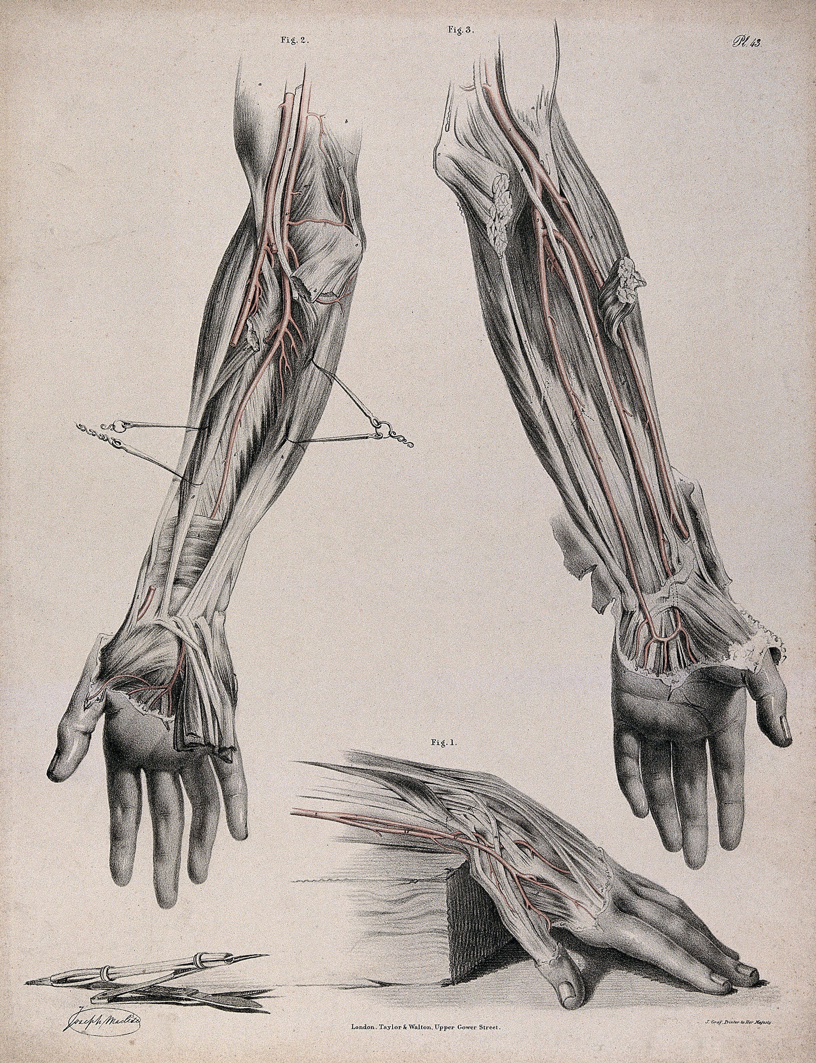 Arterial And Venous Circulation Of The Arms