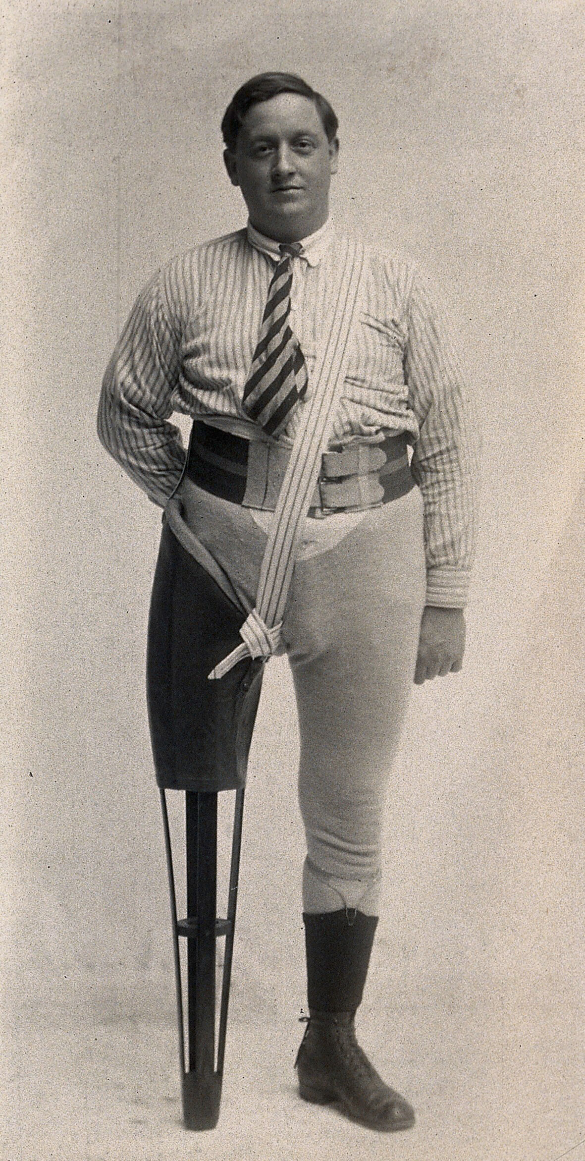A man with a wooden leg prosthesis. Photograph, ca. 1915. | Wellcome ...