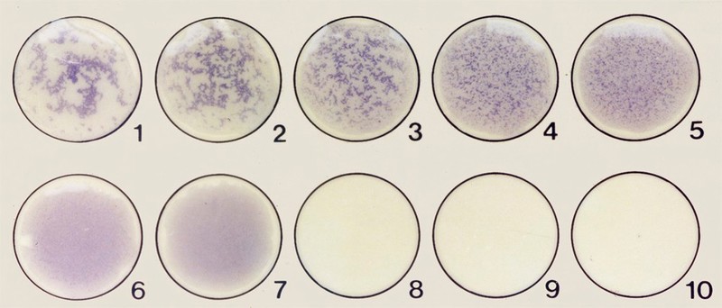 Card agglutination test for trypanosomiasis | Wellcome Collection